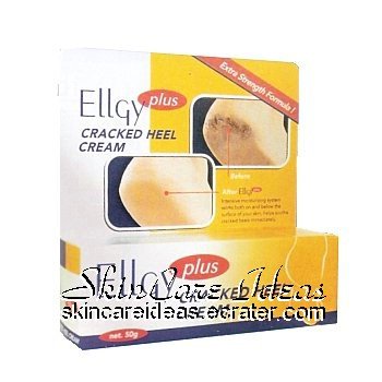Ellgy Plus Cracked Heel Cream 50g