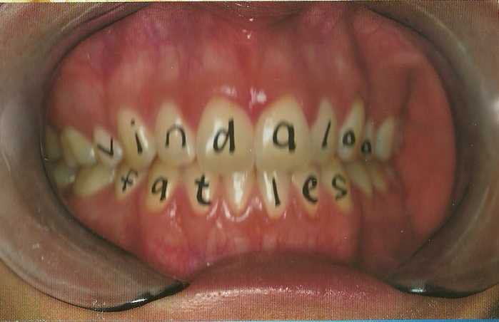 Fat Les: Vindaloo (Cassette Single)