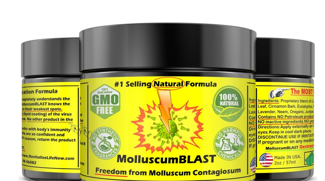 MolluscumBLAST Natural Treatment for Molluscum Contagiosum – Effective Skin Relief Cream