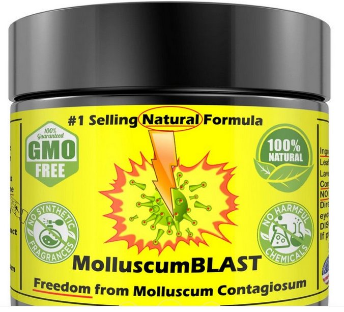 MolluscumBLAST Natural Treatment for Molluscum Contagiosum – Effective ...