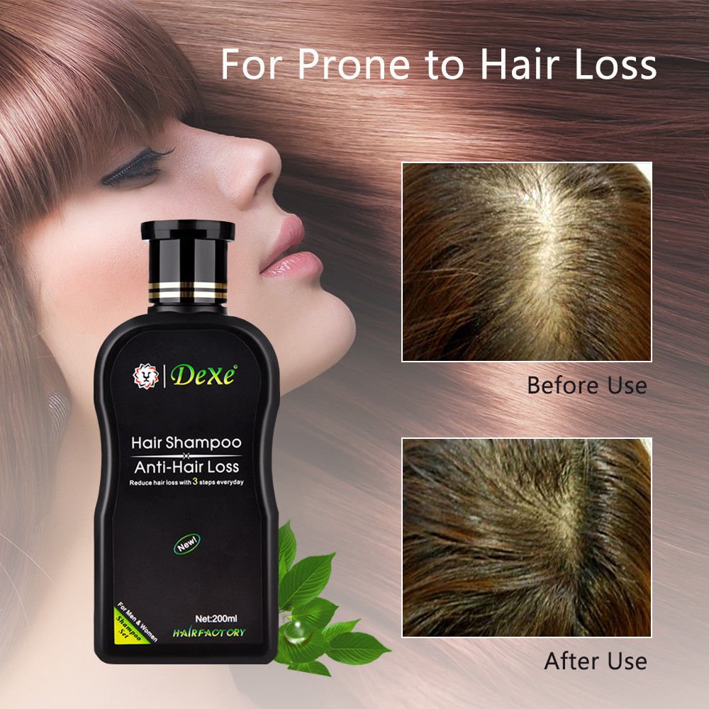 Anti Hair Loss 200ml Dexe Shampoo Chinese Herbal Induce Regeneration Growth
