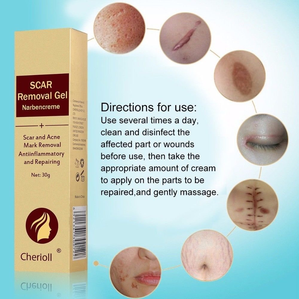 TCM SCAR AND ACNE MARK REMOVAL GEL OINTMENT (30g) Acne Scar Cream