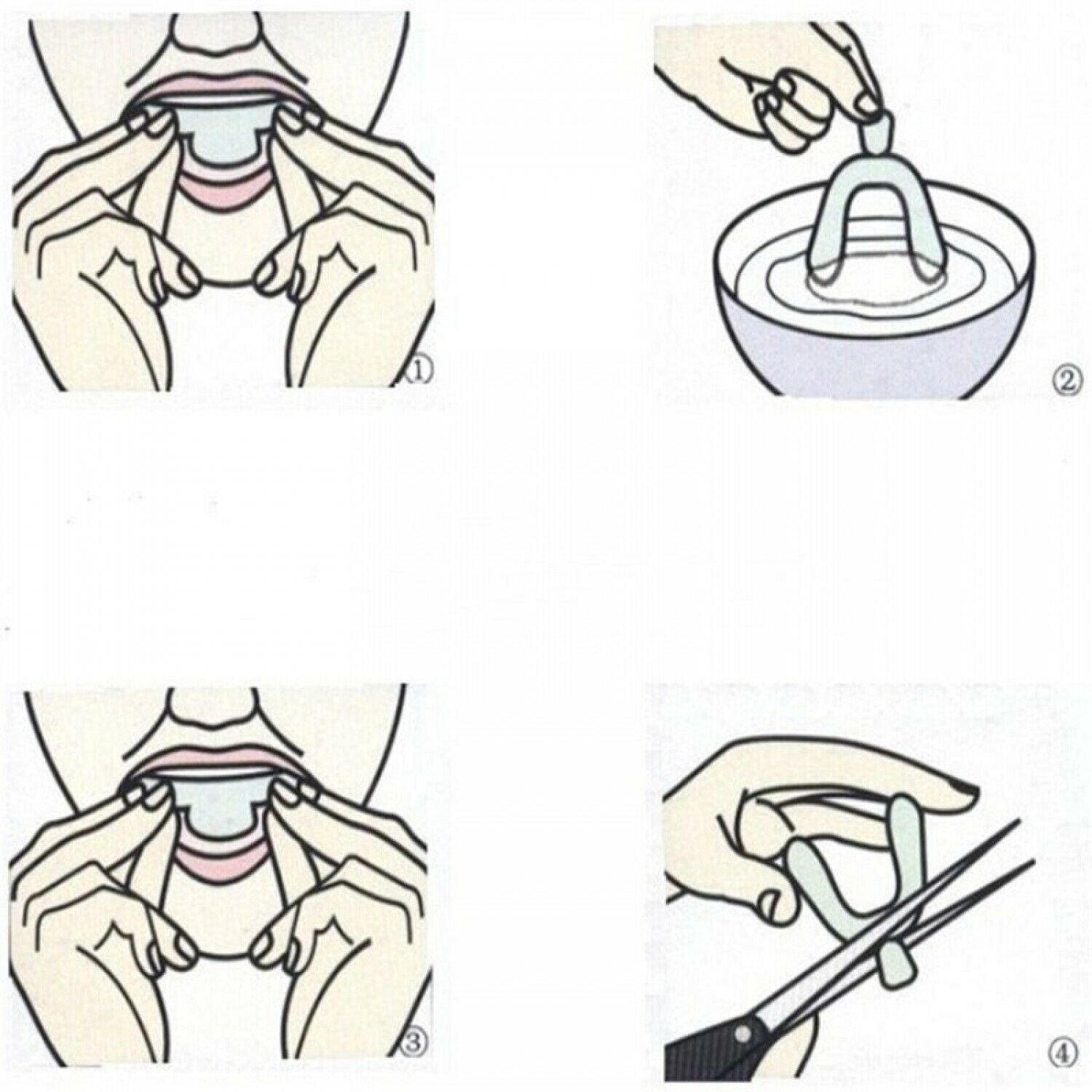 Anti-Cheek Biting Dental Guard Mouth Teeth Grinding Aid Clenching ...