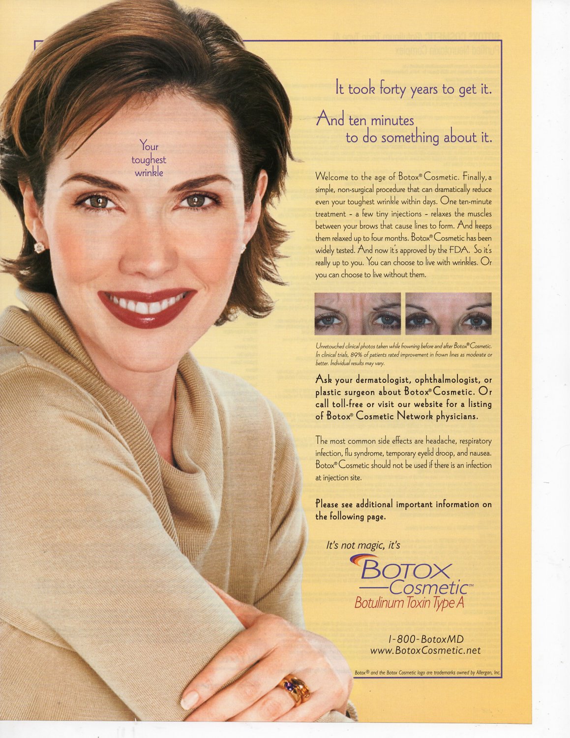 Botox vintage Magazine Print Ad October 2002