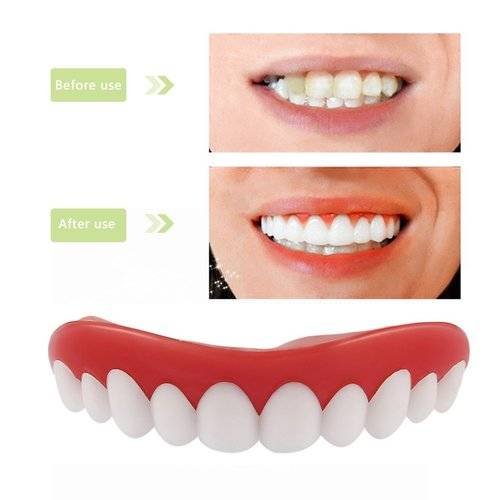 Comfortable Silicone Perfect Smile Veneers Men Women Veneer Tooth Cover