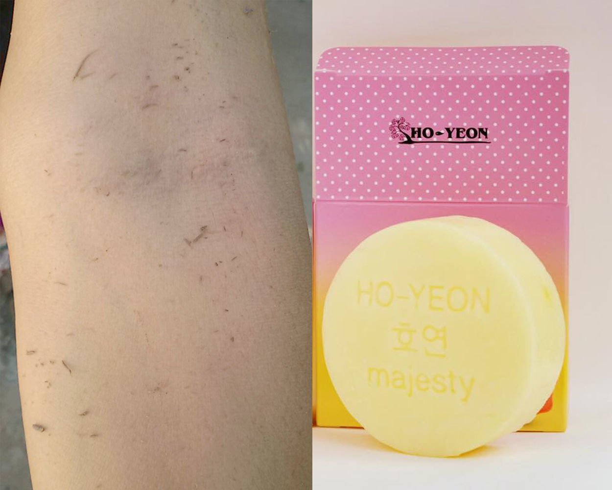 Snail+Ginseng Soap Whitening Clear Peel Scurf Skin Gluta/Arbutin/AHA By ...