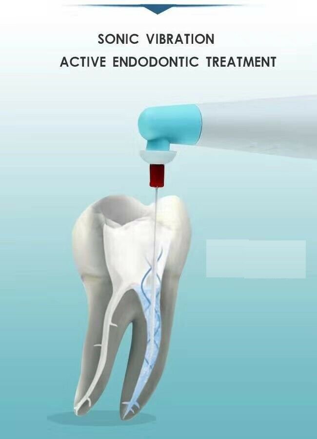 New API Sonic Endo Irrigator | 60 Tips Free | Express shipping