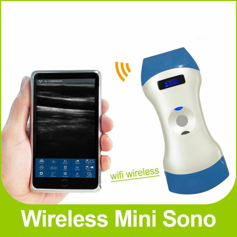 wireless mini palm ultrasound convex and linear probe double head