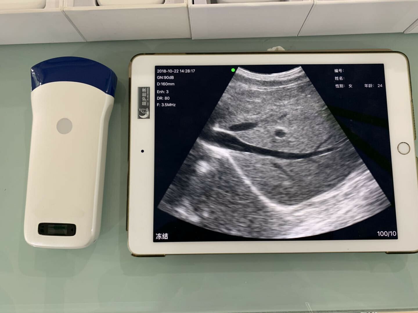 Portable Handheld mini Convex color doppler wireless ultrasound scanner ...