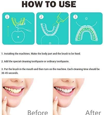 Teeth Whitening V-white 360° Ultrasonic Electric Toothbrush Sonic ...