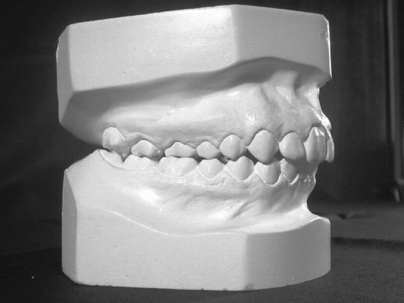 Dental gypsum powder tipe IV 1.5 LBS ( crow , bridge , acrylic resin ...