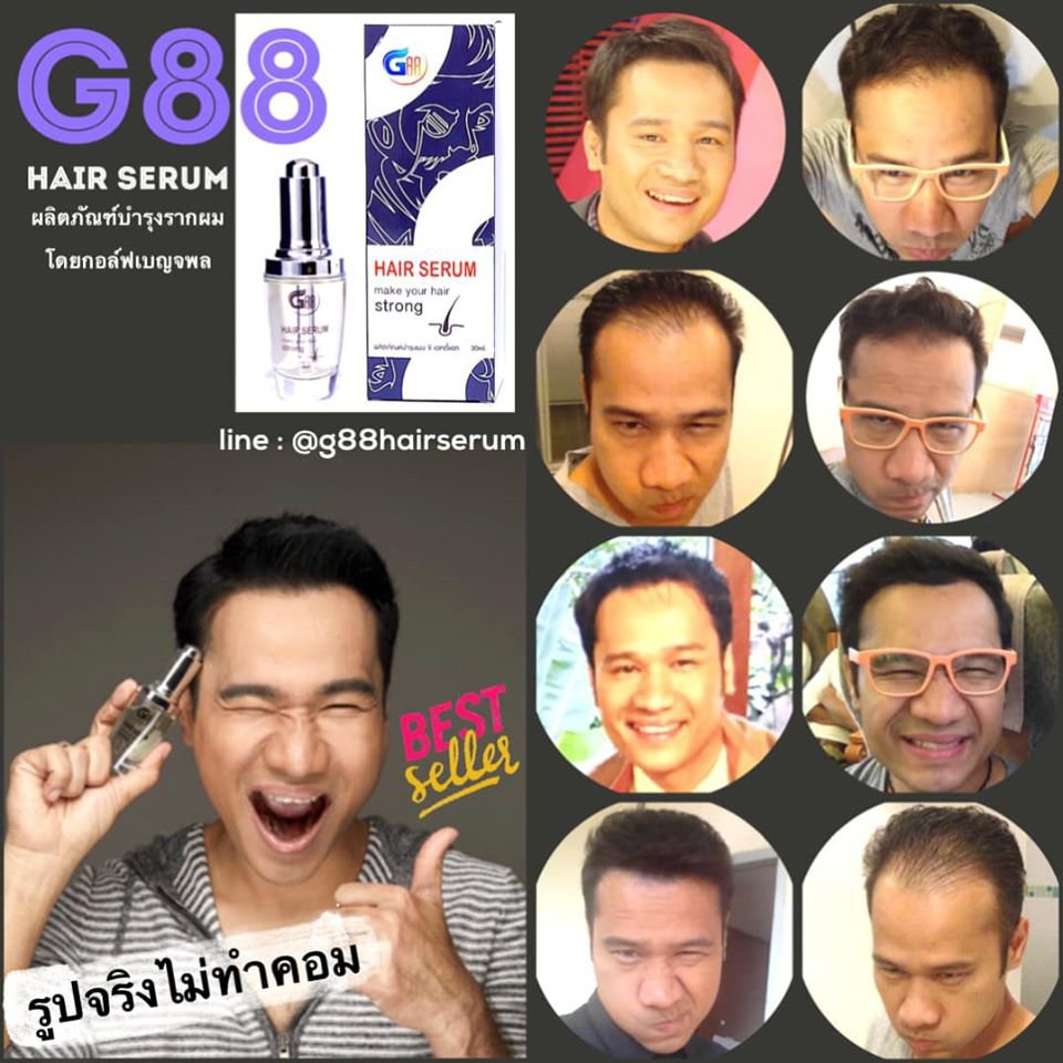 G88 Hair Serum Energizing Scalp 30ml Stimulate Hair Regrowth Loss Hair Fall Nourishing Regrow