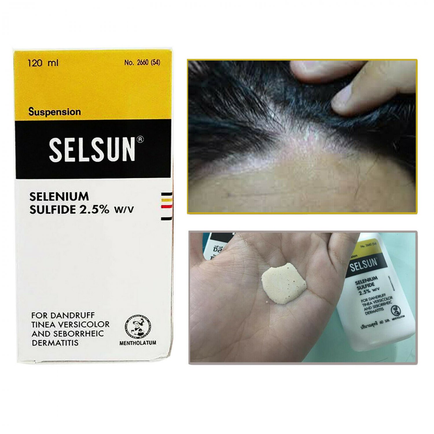 1 SELSUN Anti-Dandruff Itching Selenium Sulfide 2.5% Shampoo 120ml./4oz ...