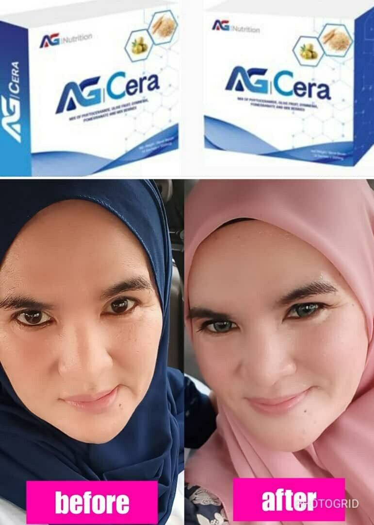 1x Original AG Cera Nutrition Supplement vitamins for men and women 14 ...