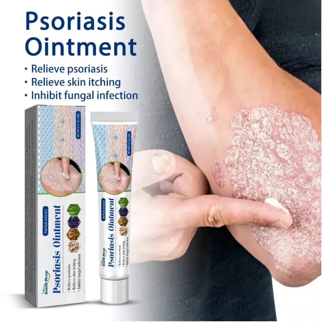 Psoriasis Dermatitis Eczema Natural Cream Skin Treatment Ointment FREE ...