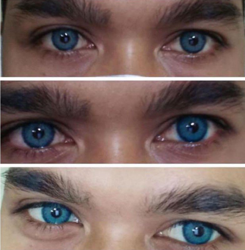 4 Bottles/ Collyre Blue Eye Drops Exp 2025