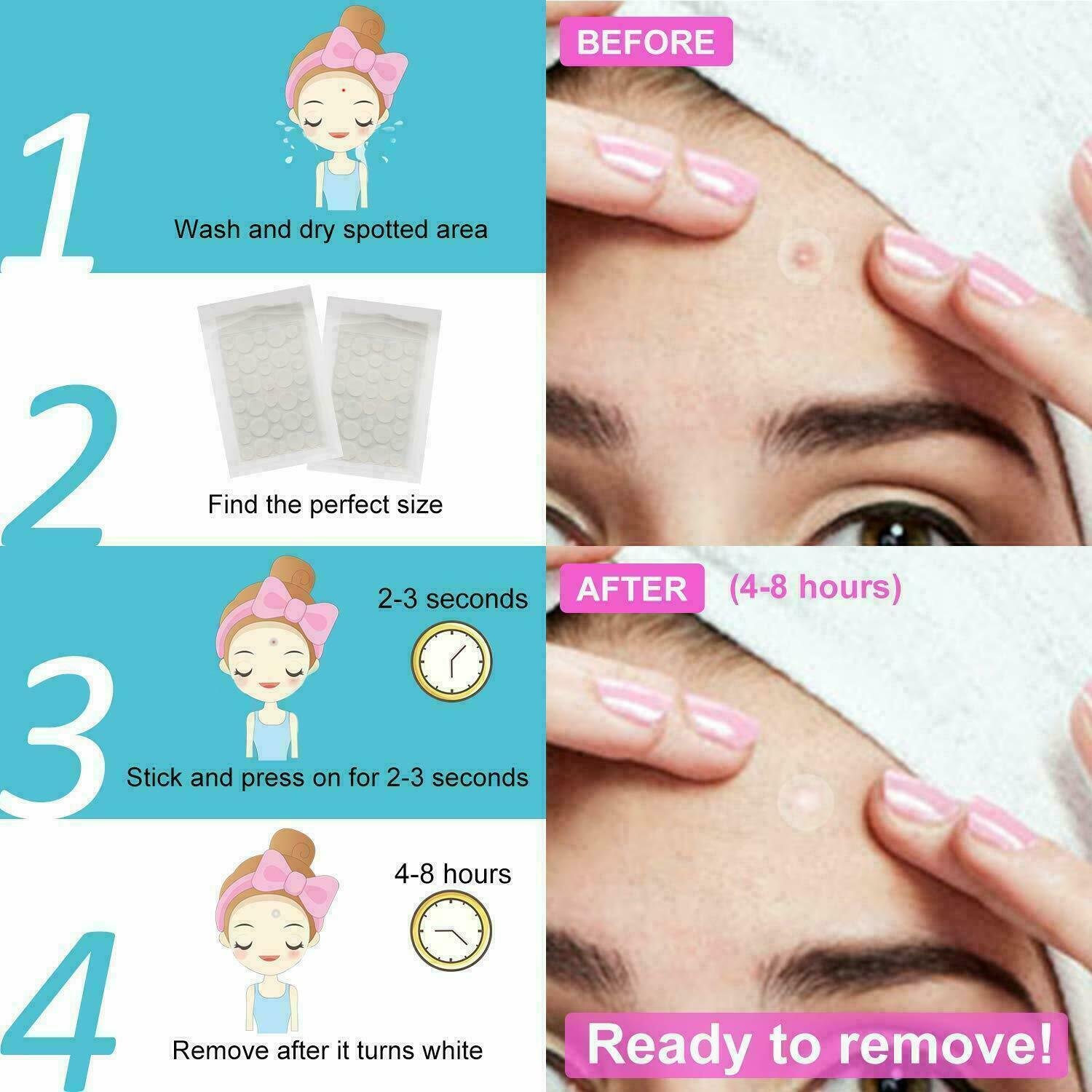 Acne Pimple Dots for Spots Patches Face Treatment Blister Stickers ...