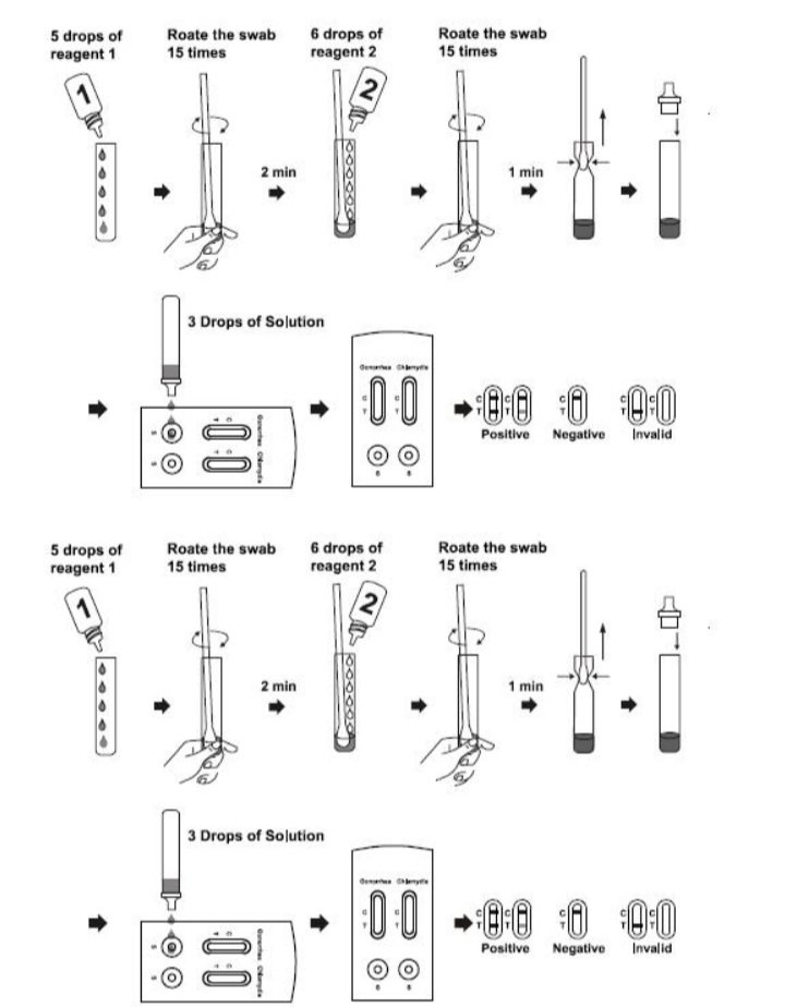Gp Professional Chlamydia Syphilis And Gonorrhoea Male And Female Swab