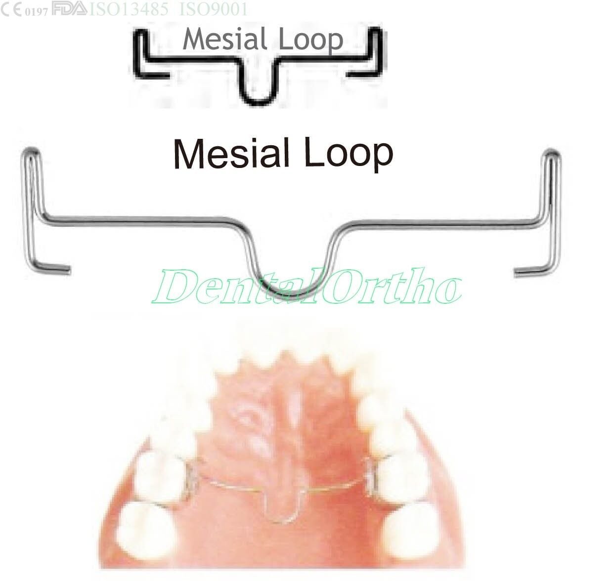 50 x Palatal Arch Bar Mesial Loop Dental Orthodontic Multi Size Mixed