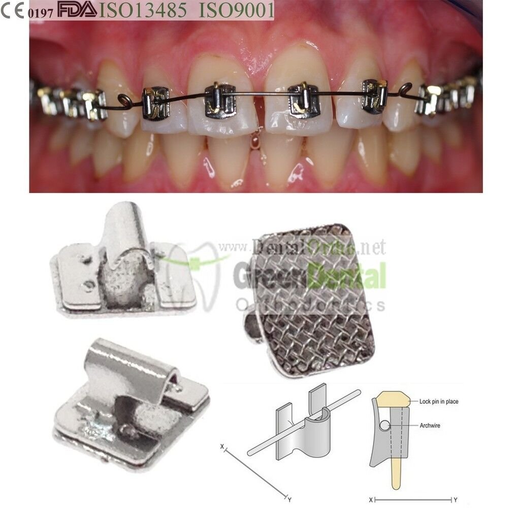 100/PK, Begg Brace Flat Base Dental Orthodontic Materials