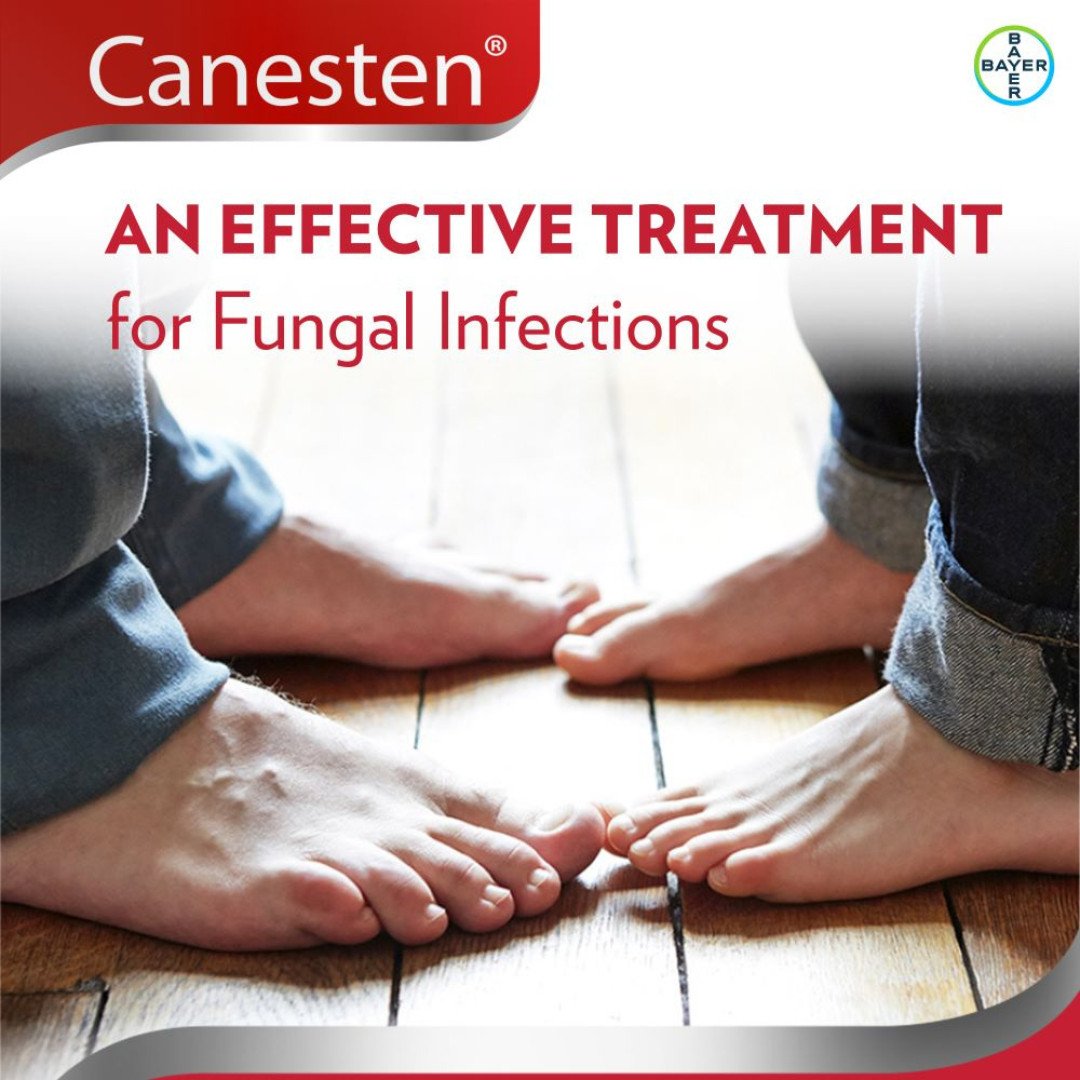 2 X Canesten Cream 20g Antifungal Ringworm Infection Athlete's Foot