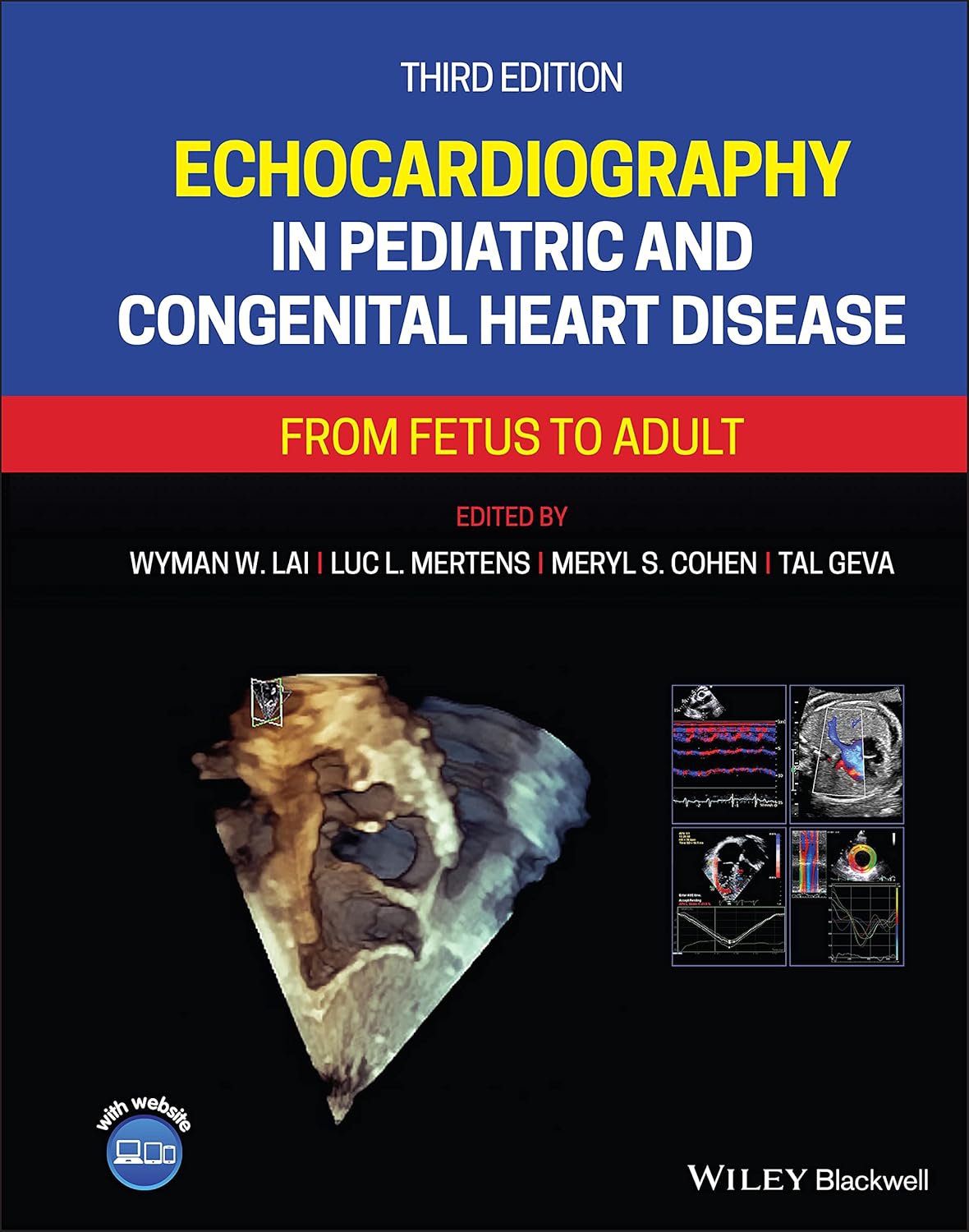 Echocardiography in Pediatric and Congenital Heart Disease From Fetus to Adult 3rd Edition