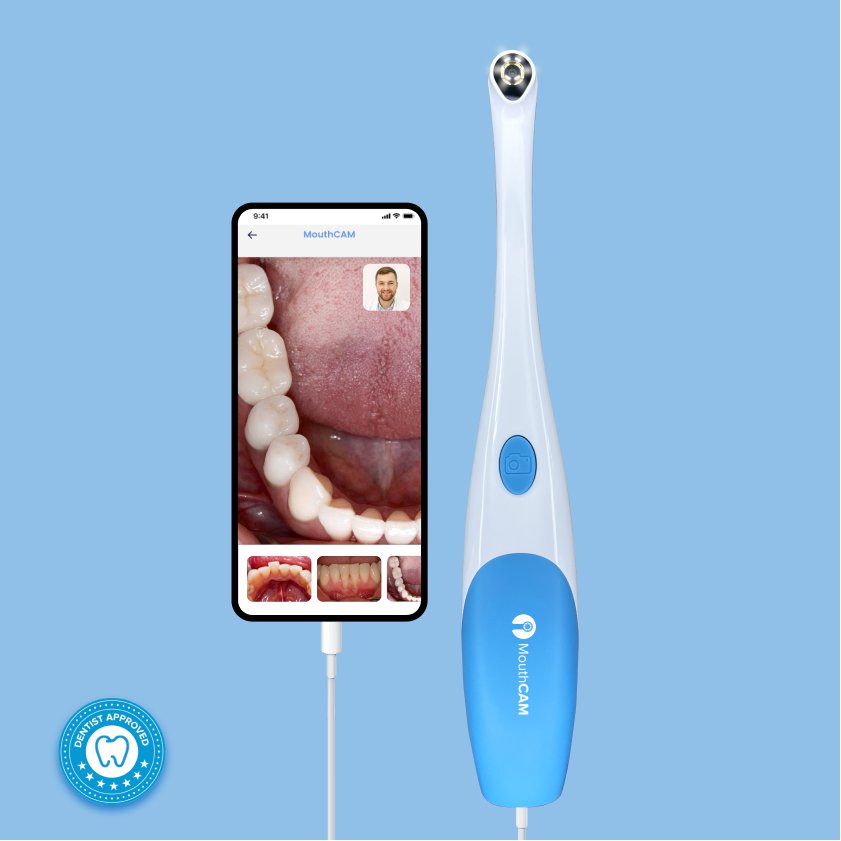 USB Personal Dental Intraoral Camera